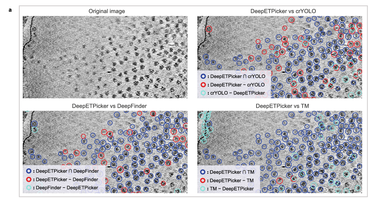 【论文阅读|cryoET】DeepETPicker：使用弱监督深度学习的快速准确cryoET三维颗粒挑选算法-CSDN博客