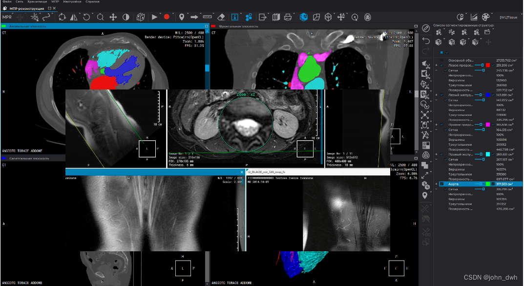 INOBITEC PRO DICOM VIEWER 2.9.0 Crack_crack:inobitec dicom viewer 2.9.0 中文版-CSDN博客