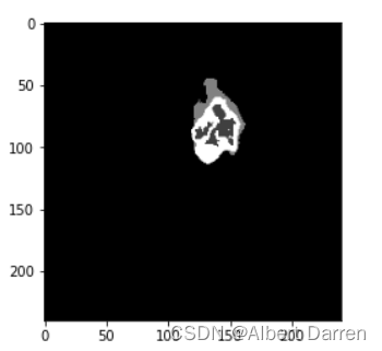 Python第三方库之MedPy-CSDN博客