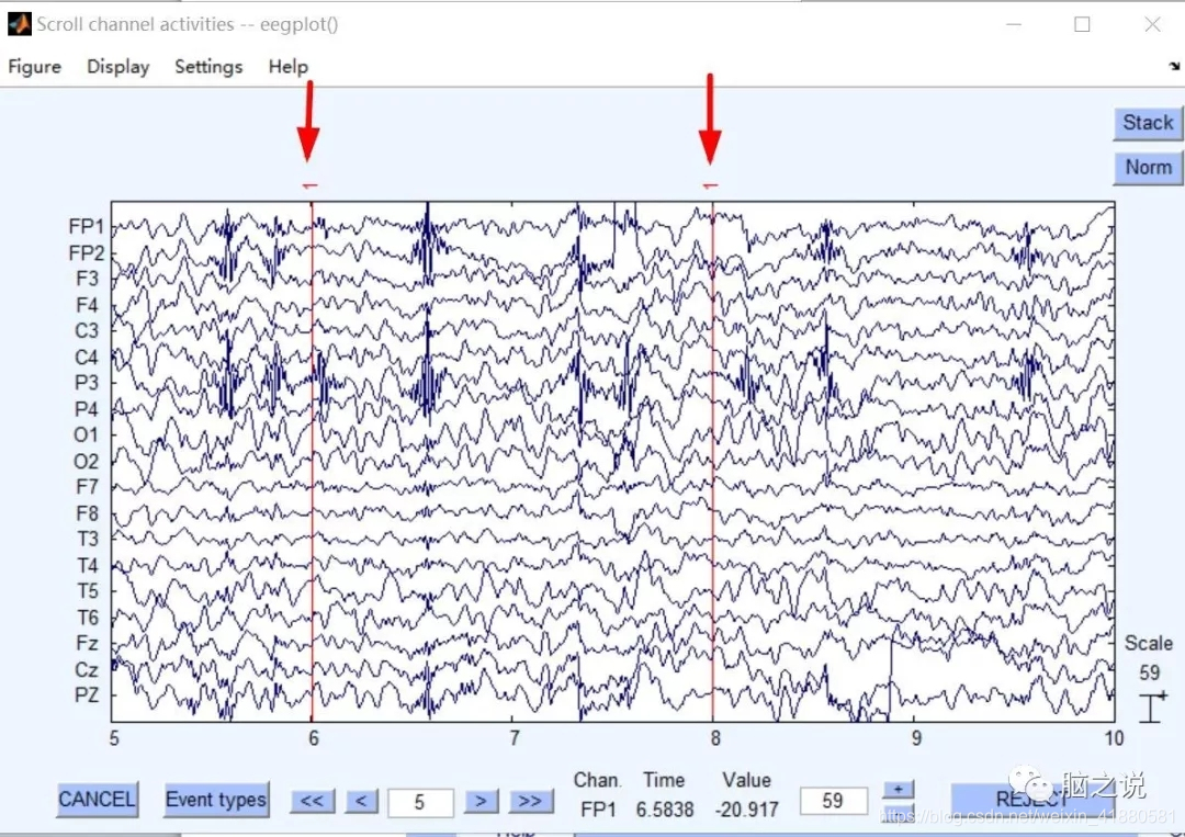 如何利用EEGlab工具包在EEG数据中手动插入Marker？_eeglab 手动打点-CSDN博客