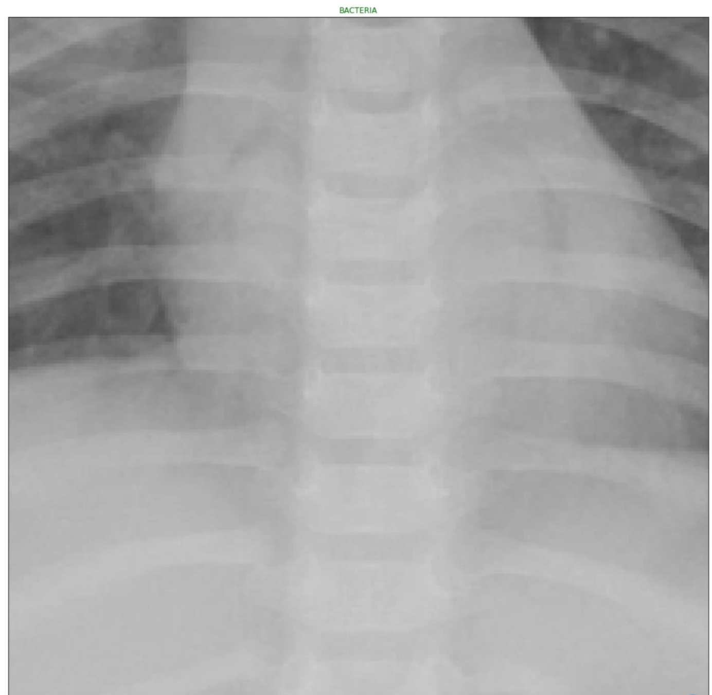 Python基于改进Resnet和Vgg新冠肺炎分类[源码＆部署教程]_vgg的改进-CSDN博客