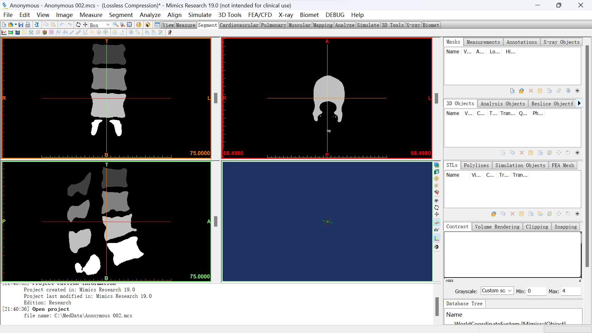 2023-06-27-mimics，slicer软件将.nii.gz转为.ply格式_mimics可不可以导入nii图像-CSDN博客