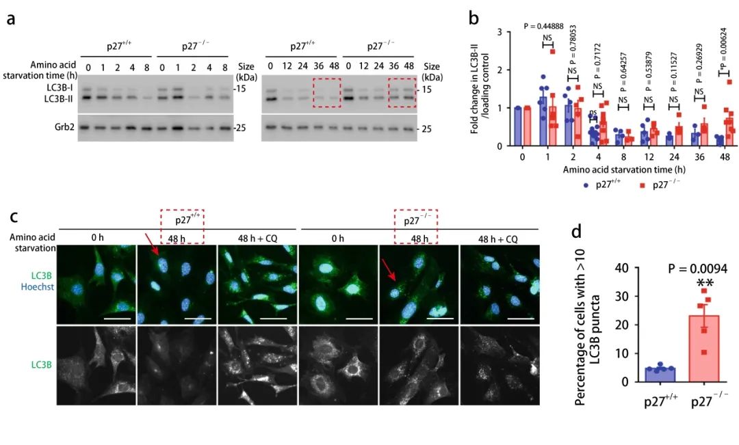 自噬与细胞周期调控：p27的新角色-CSDN博客