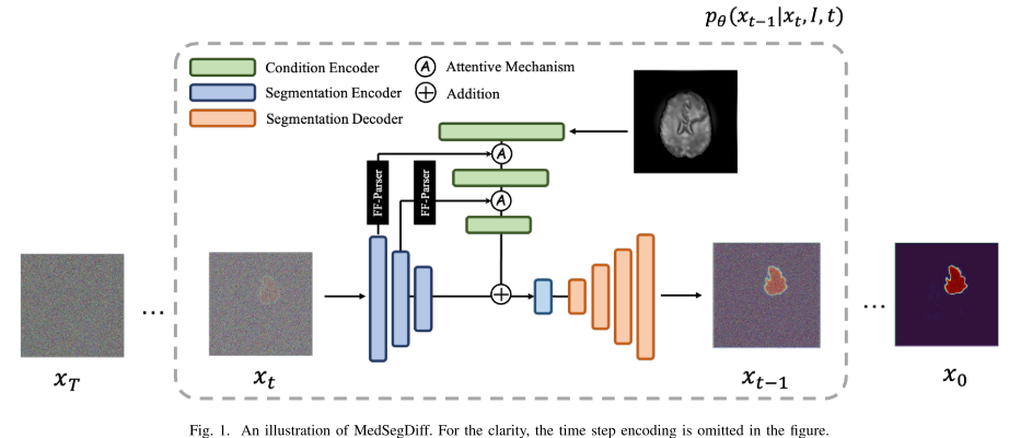 MedSegDiff: Medical Image Segmentation with Diffusion Probabilistic Model 论文总结-CSDN博客