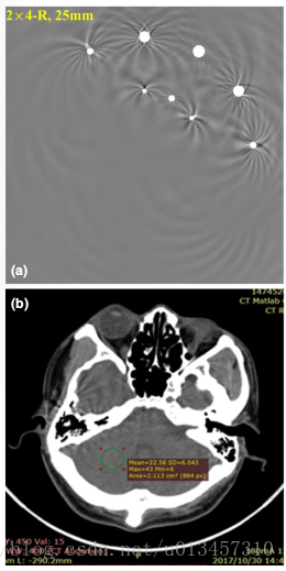论文笔记 圆轨道MDCT/CBCT锥角伪影及如何抑制[1]_parker权重-CSDN博客