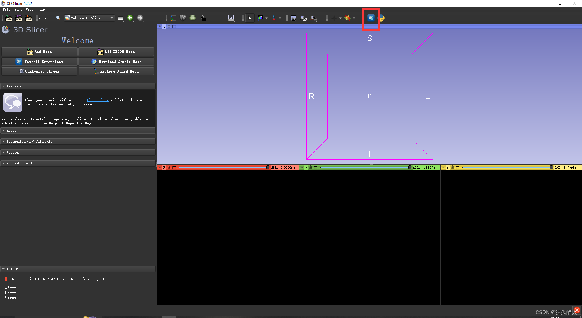 使用3D Slicer进行图像配准_使用3dslicer配准lpba40-CSDN博客
