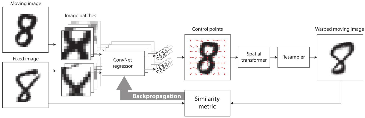 【论文笔记】基于深度学习的端到端无监督配准模型——变形图像配准网络（Deformable Image Registration Network, DIRNet）_end-to-end ...