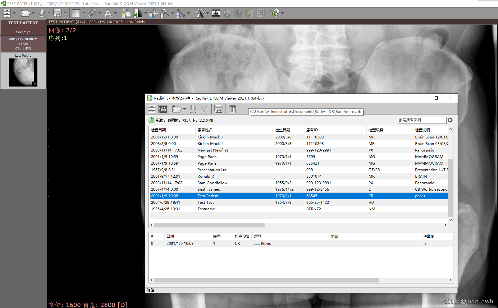RadiAnt DICOM Viewer 2021 绿色版_radiant dicom viewer绿色-CSDN博客