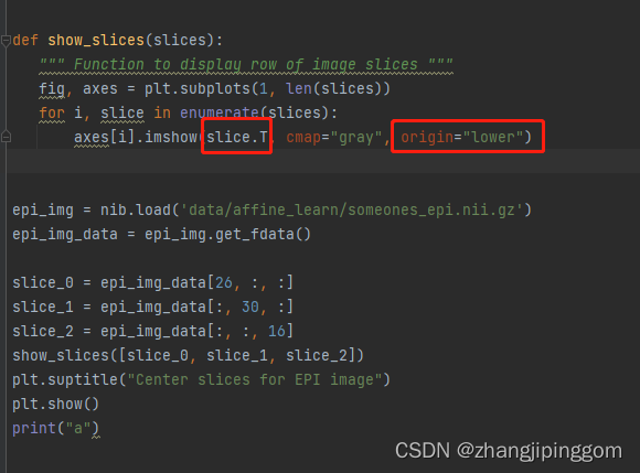 3D医学图像二维可视化-CSDN博客