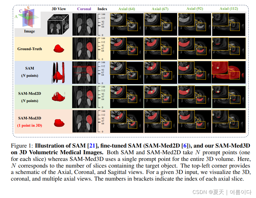 CV | SAM在医学影像上的模型调研【20240223更新版】_medsam 2024-CSDN博客