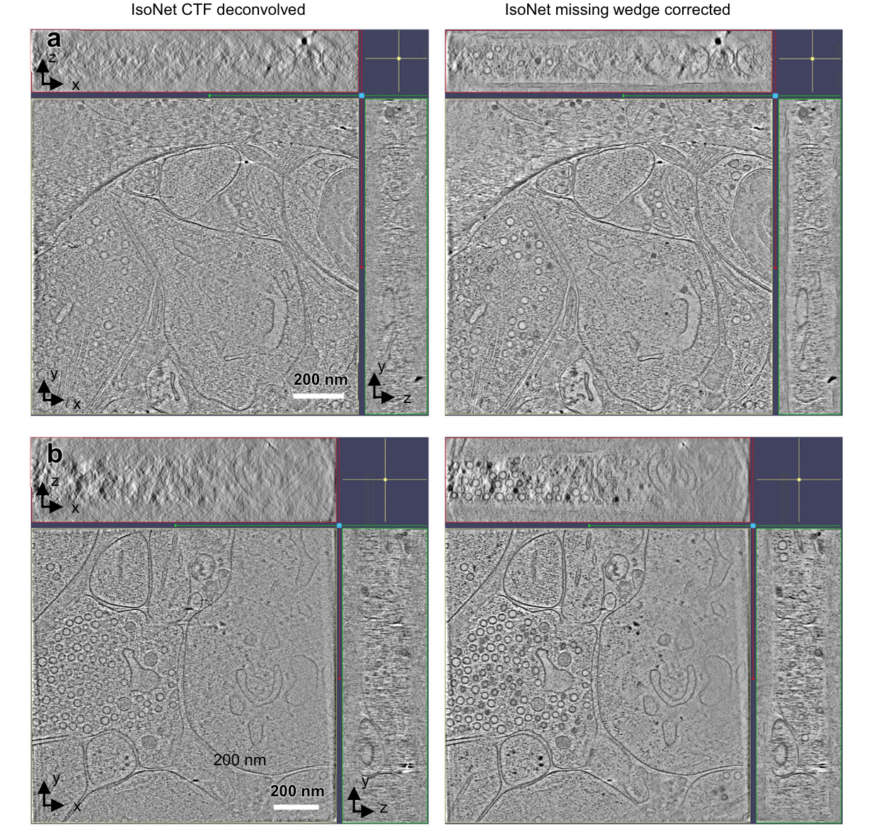 【论文阅读|cryoET】Isotropic reconstruction for electrontomography with deep ...