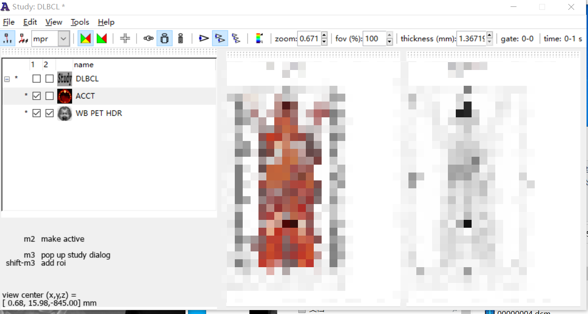如何使用imageJ做Z方向的投影？_image j怎么做三维最大投影-CSDN博客