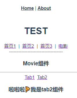 vue-router入门学习2_vuerouter 为什么可以增加 router的属性-CSDN博客