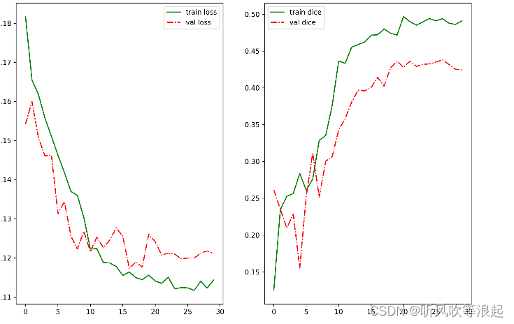 基于UnetPlusPlus(Unet++)实现的医学图像分割-CSDN博客