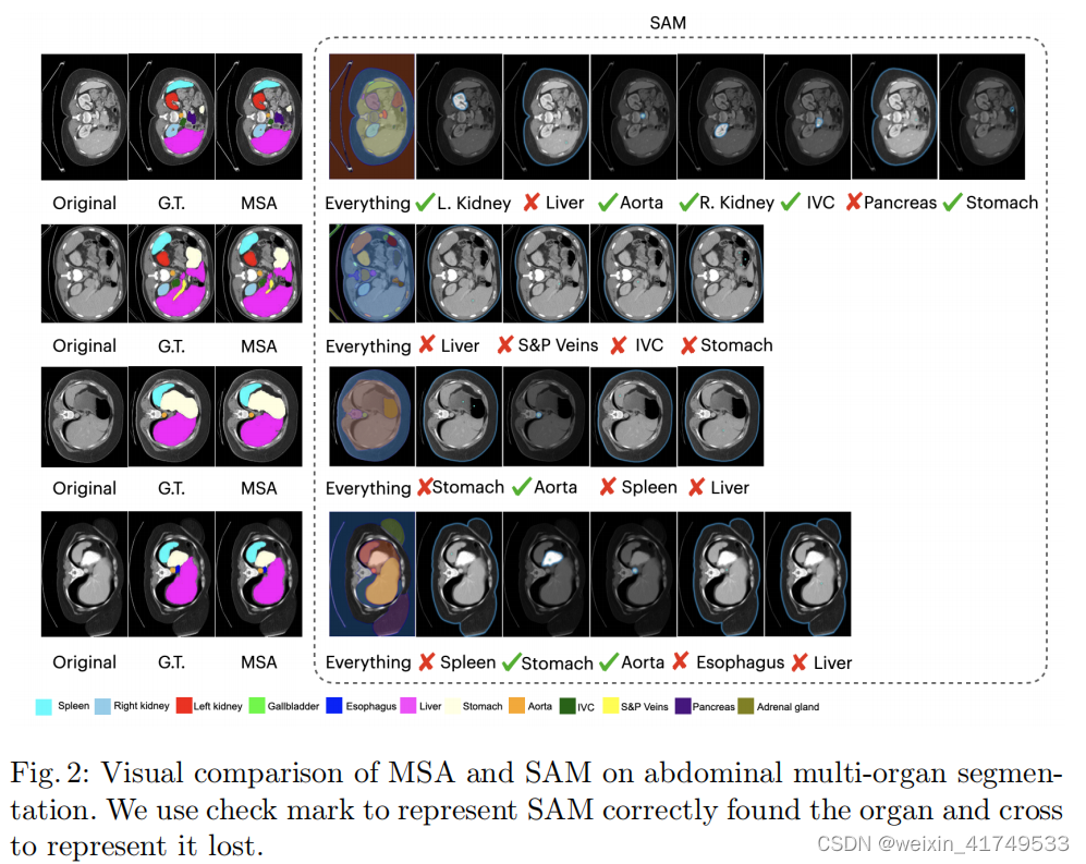 Medical SAM Adapter: Adapting SegmentAnything Model for Medical Image ...