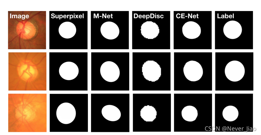 CE-Net: Context Encoder Network for 2D Medical Image Segmentation_gu 等人于2019年提出一种上下文编码网络ce-net ...