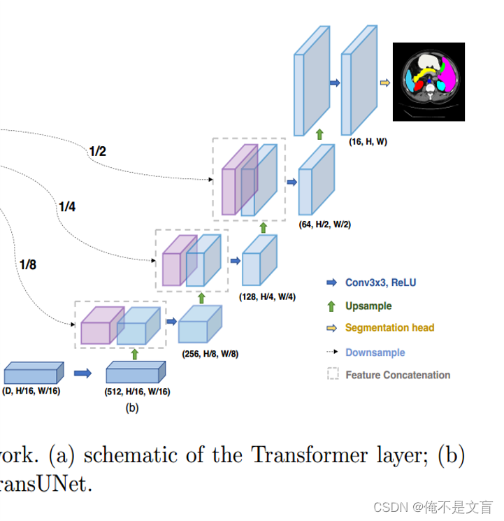 论文研读：Transformers Make Strong Encoders for Medical Image Segmentation ...