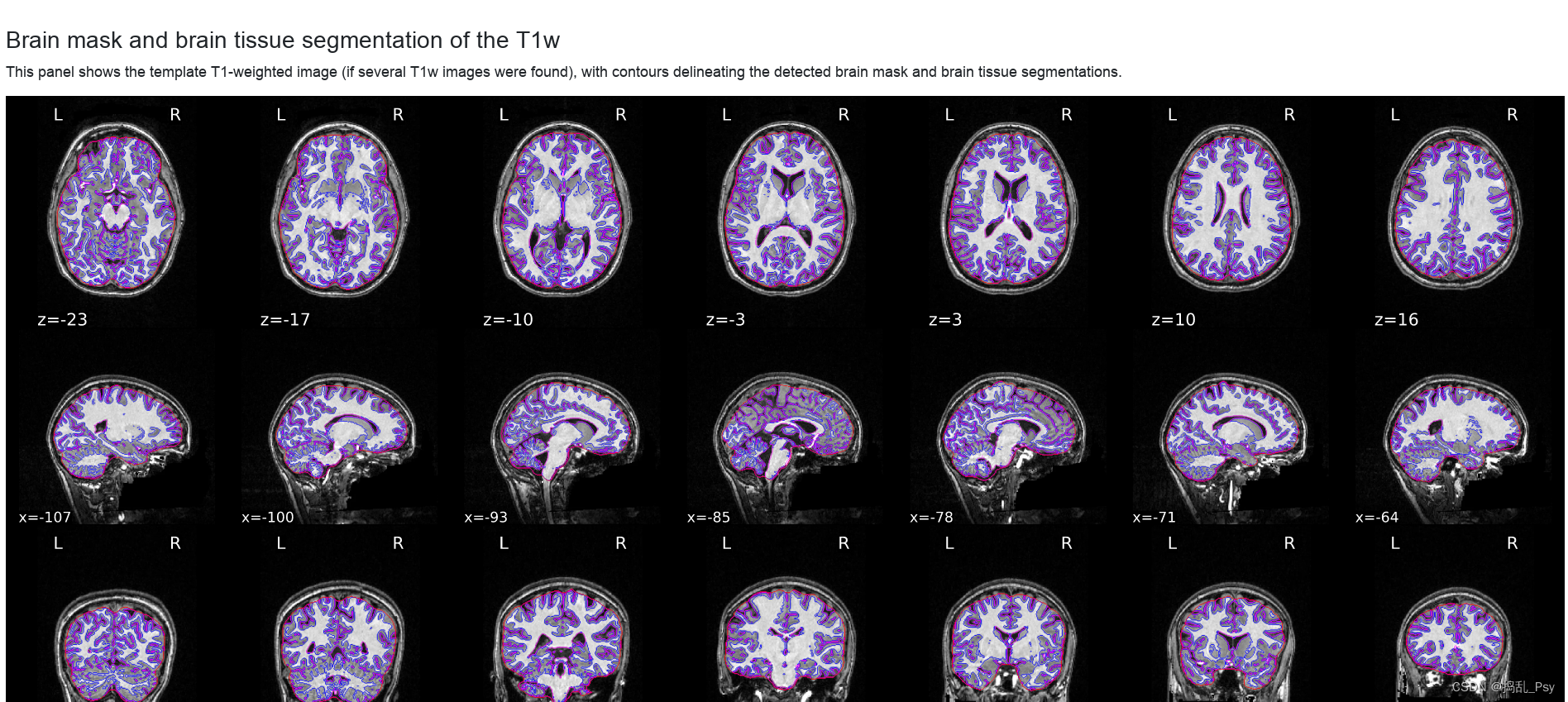 fMRI数据处理_预处理_3_批处理和结果解读_fmriprep-CSDN博客