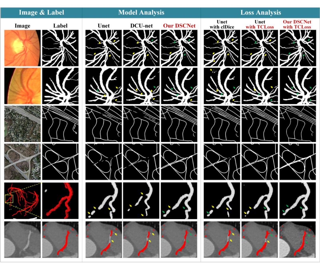ICCV 2023 | 动态蛇形卷积（Dynamic Snake Convolution）用于管状结构分割-CSDN博客