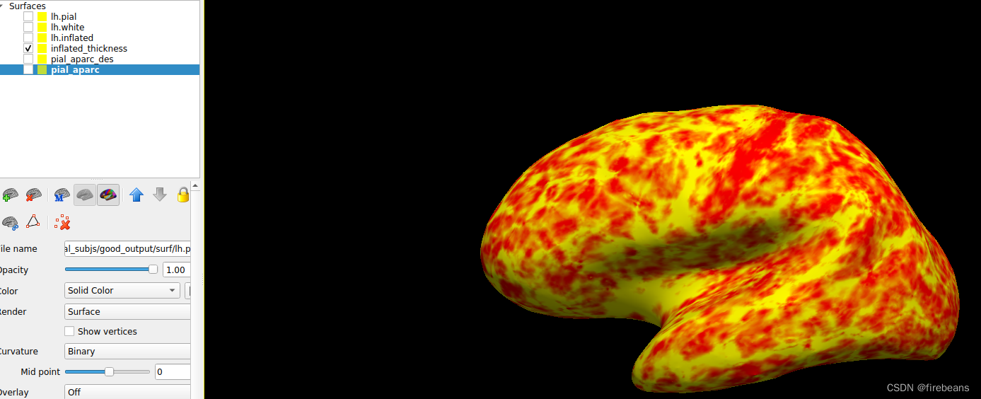 FreeSurfer入门(1) Output Data-CSDN博客
