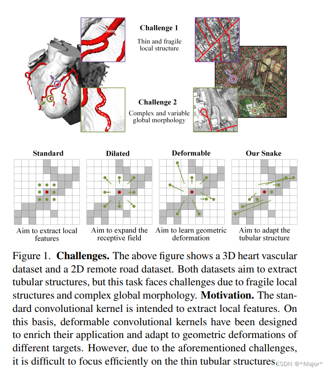 蛇形卷积(Snake Convolution)---DSCNet-CSDN博客