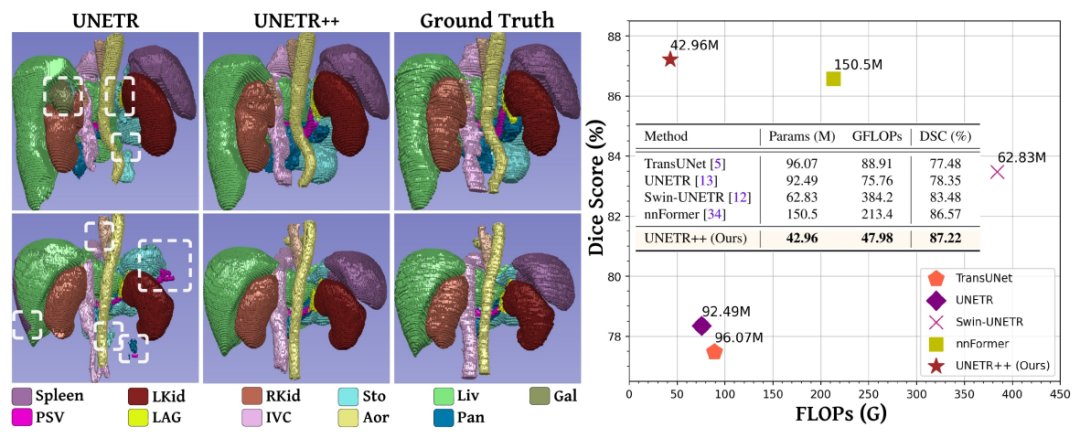 超越nnFormer！UNETR++：高效准确的3D医学图像分割_unetr++: delving into efficient and accurate 3d me-CSDN博客