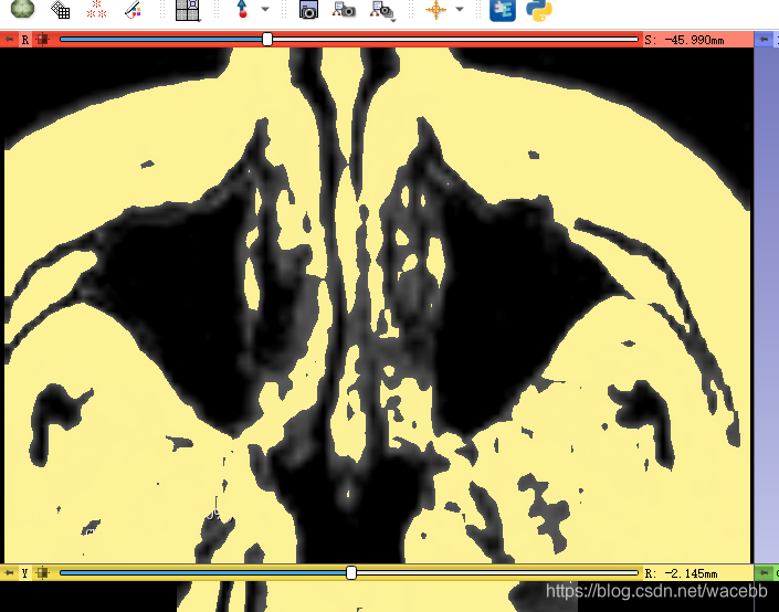 超级简单的3D slicer教程（三）creating label Map_3d slicer roi删除-CSDN博客
