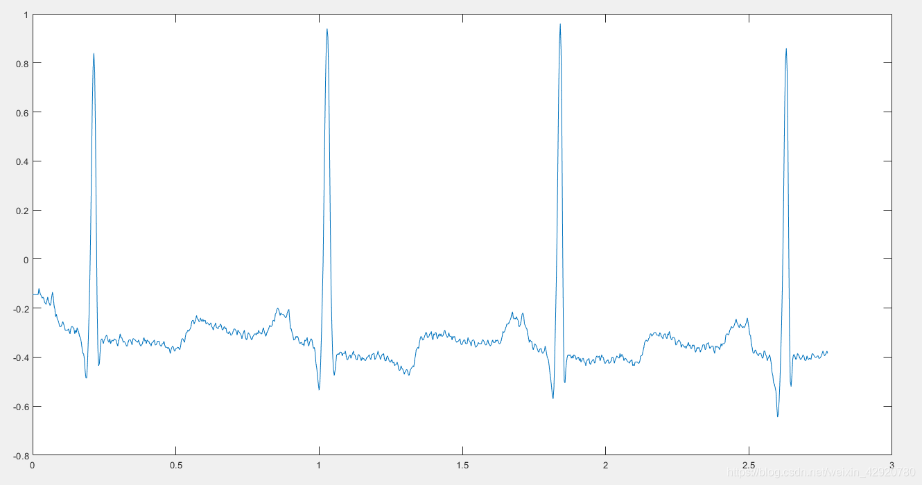 MATLAB的WFDB软件下载及使用_matlab怎么用wfdb包处理.dat-CSDN博客