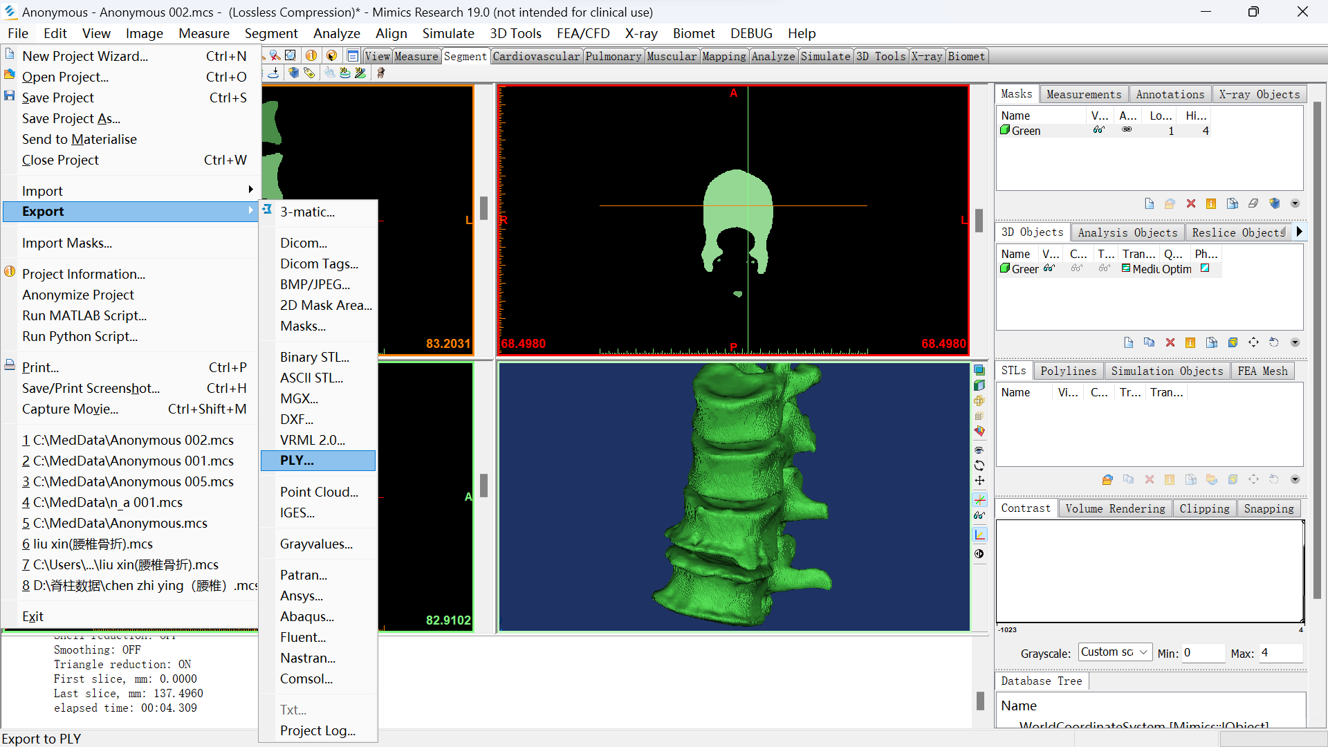 2023-06-27-mimics，slicer软件将.nii.gz转为.ply格式_mimics可不可以导入nii图像-CSDN博客