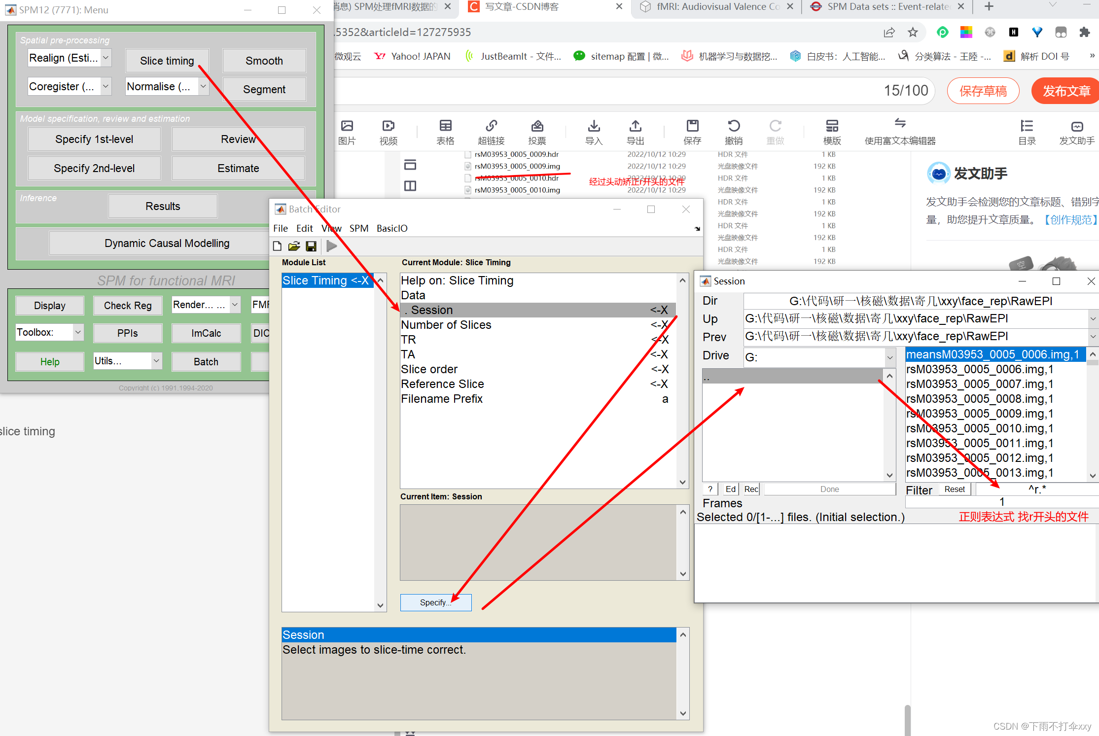 【matlab】spm数据处理_matlab spm-CSDN博客