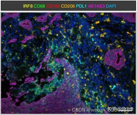 多重荧光免疫组化（mIHC）实验原理-CSDN博客