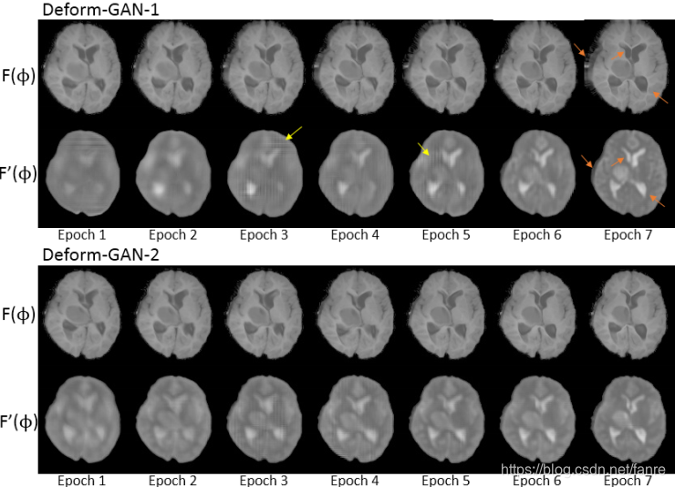 DEFORM-GAN:AN UNSUPERVISED LEARNING MODEL FOR DEFORMABLE REGISTRATION-CSDN博客