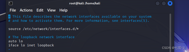 kali Linux 连接 Xshell_kali可以使用shell链接吗-CSDN博客