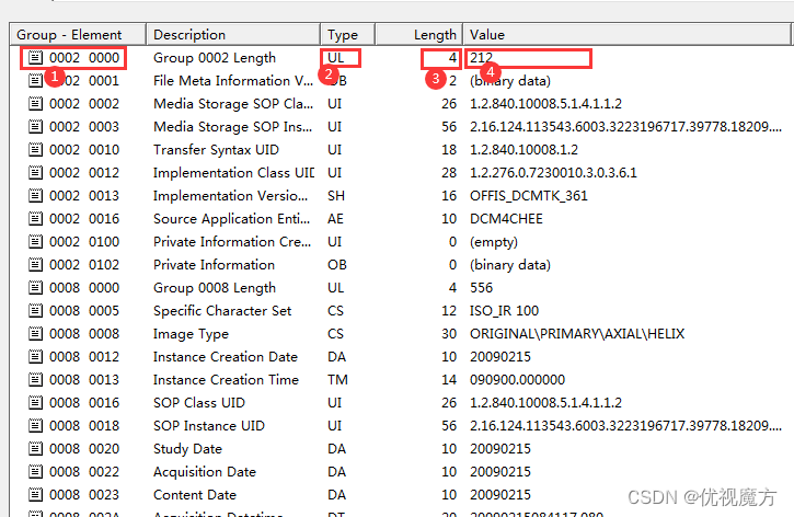 连载：徒手写一个DICOM阅图软件（002）之DICOM图显示_c# 开发dicom-CSDN博客
