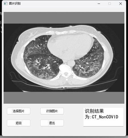 通过python-CNN训练识别CT患病-含数据集+pyqt界面_pytorch判断患病-CSDN博客