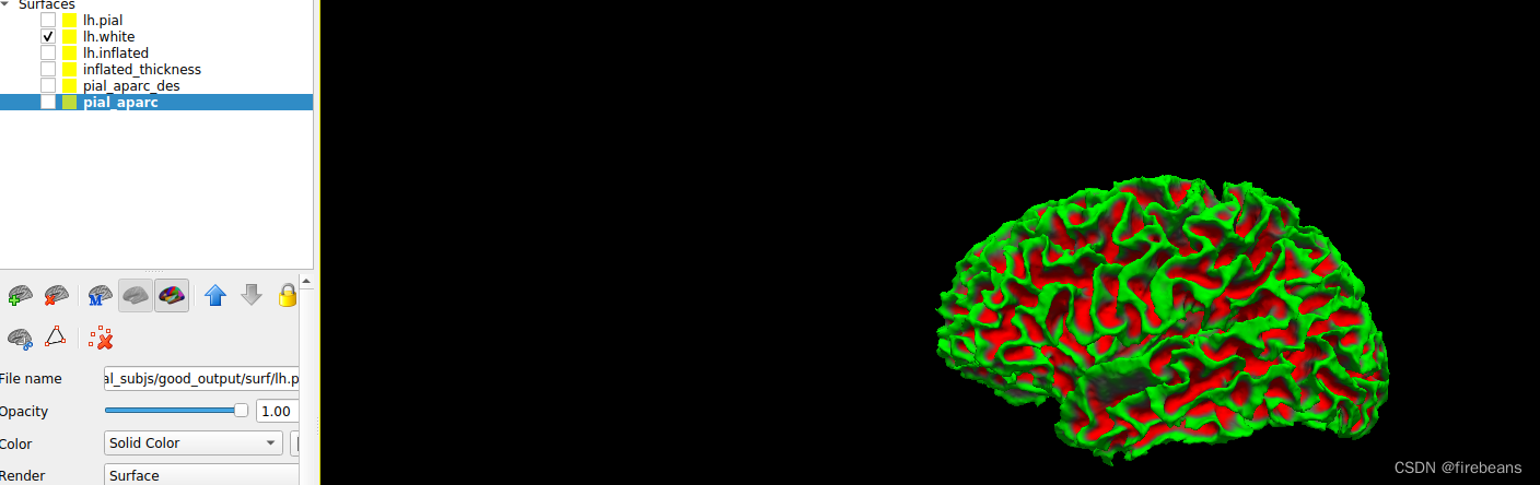 FreeSurfer入门(1) Output Data-CSDN博客