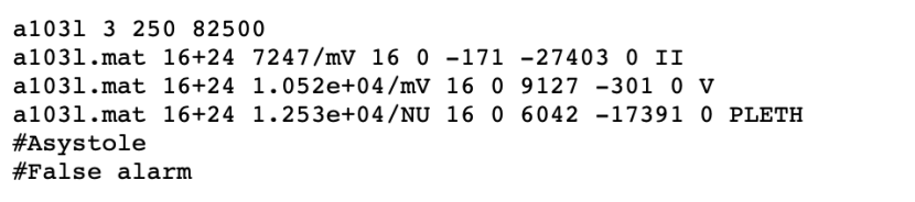 PhysioNet challenge2015 数据库_hea文件-CSDN博客