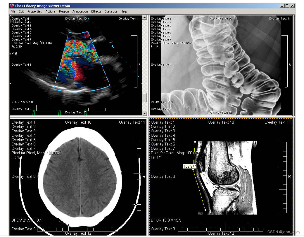 LEADTOOLS 22-23 .Net/NetCore/JS/JAVA/Win/Linux-CSDN博客