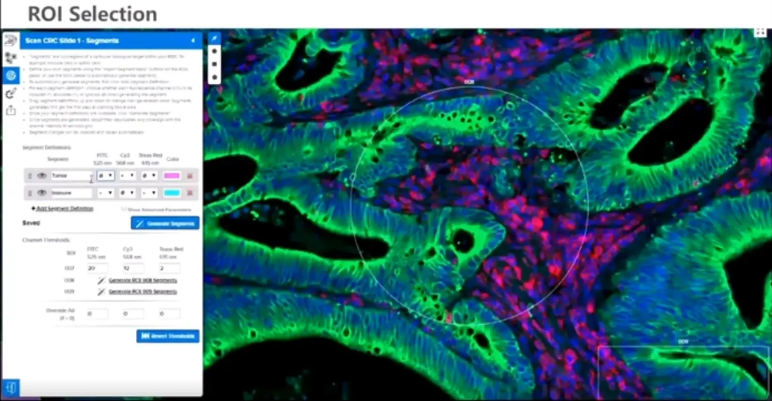 空间转录组检测靶点定量技术----Digital Spatial Profiler（DSP）_dsp空间转录组-CSDN博客