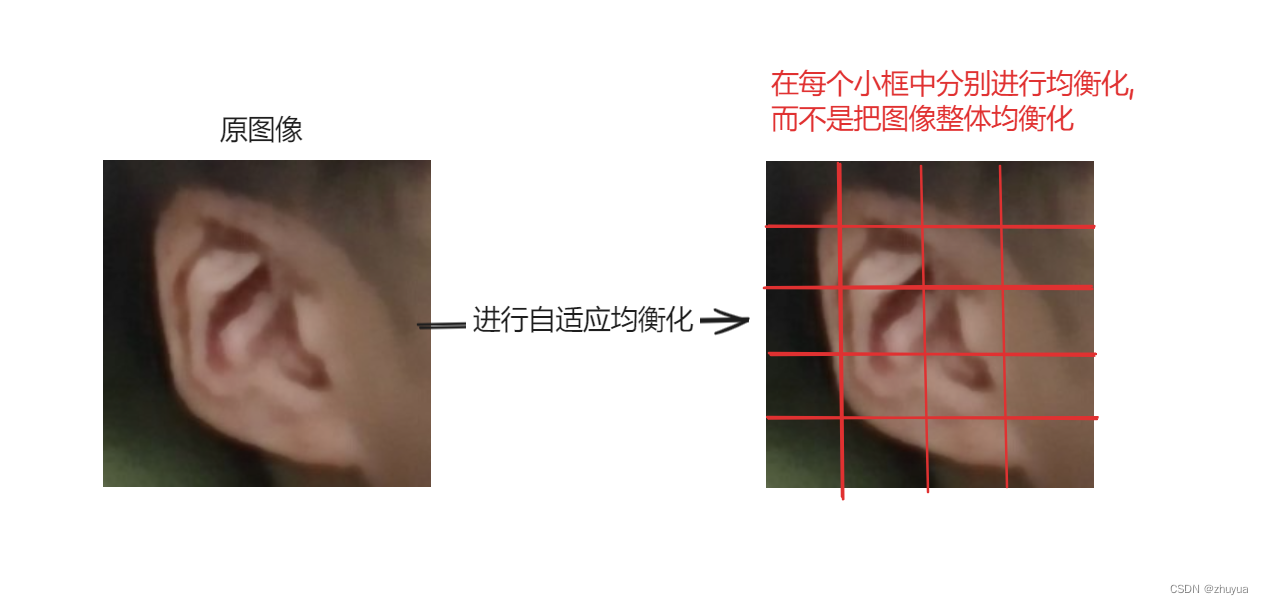 OpenCV中的CLAHE算法：图像均衡化保持细节-CSDN博客