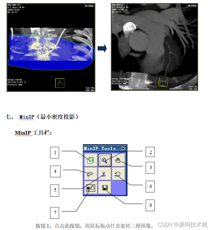 PACS（CT、CR、DR、MR、DSA、RF医院影像管理系统源码）_c# 影像系统源码-CSDN博客