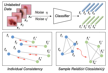 自监督论文阅读系列：TMI20 基于样本相似度的半监督学习用于医学图像分类_semi-supervised medical image classification with -CSDN博客
