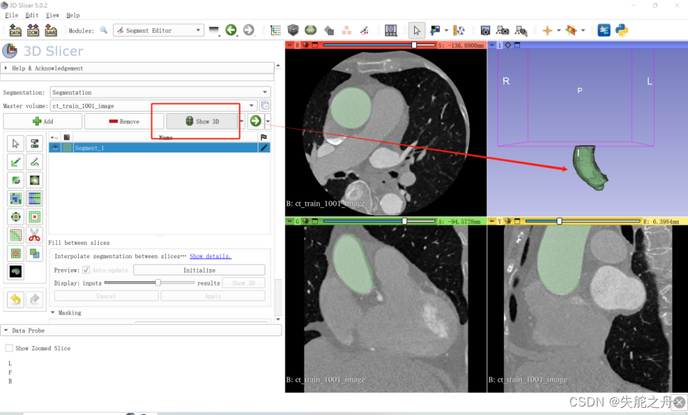 【3D Slicer】心脏CT图像分割操作保姆级教程 Cardiac CT image segmentation_3dslice 分割使用教程-CSDN博客