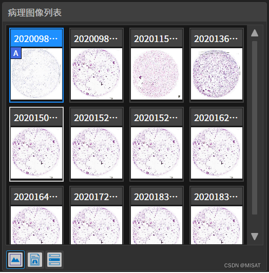 MISAT医学图像分割与标注软件套装专业版正式上线-CSDN博客