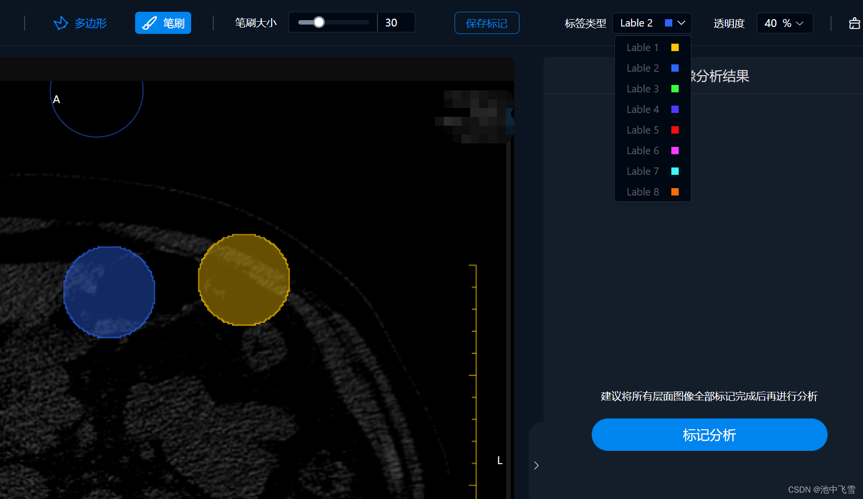 cornerstoneTools笔刷工具标记一次清除所有图层标记_cornerstonetools.register-CSDN博客