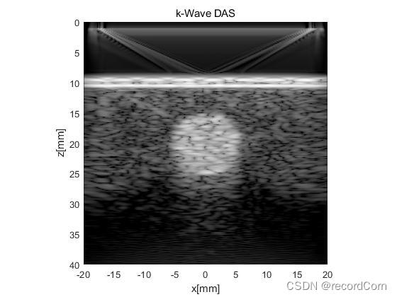 人体组织平面波超声成像仿真(MATLAB k-Wave仿真)_wave3000超声仿真-CSDN博客
