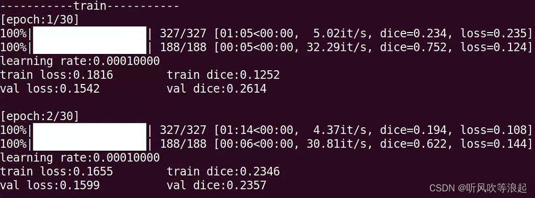 基于UnetPlusPlus(Unet++)实现的医学图像分割-CSDN博客