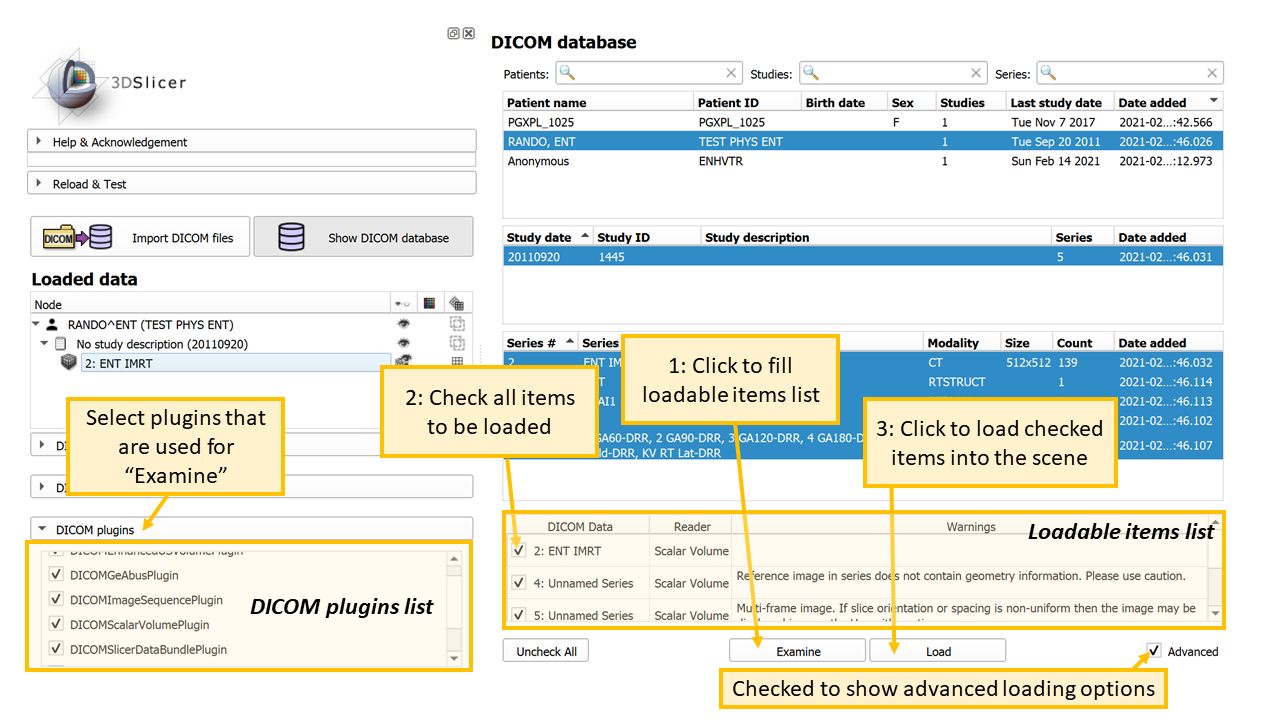 3D Slicer：从入门到精通——数据模块之DICOM_3dslicer-CSDN博客