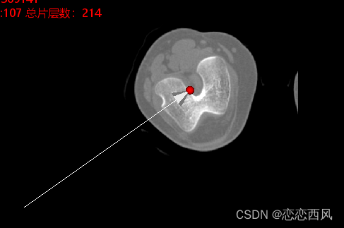 VTK 标注类Widget 文字标注 vtkCaptionWidget-CSDN博客