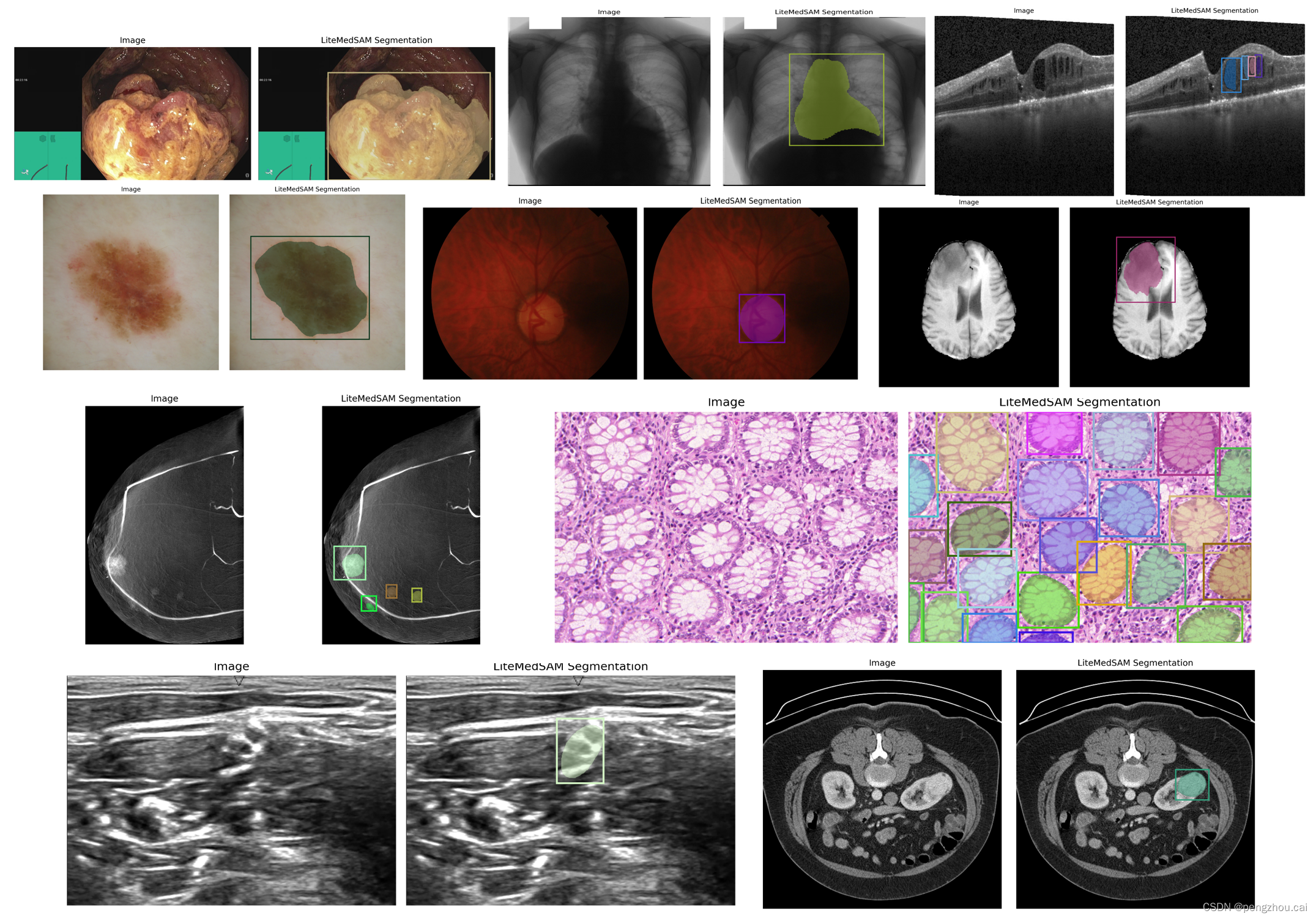 复现Lite-MedSAM-CSDN博客